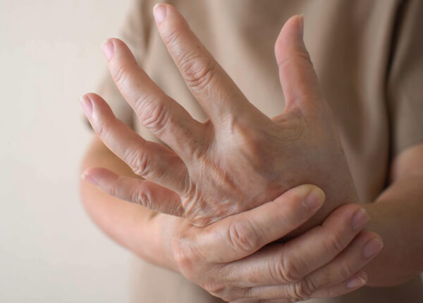 Lupus Symptoms & Treatment | Dermatology Inc.