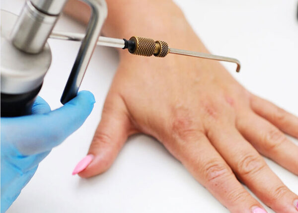 Warts Causes & Treatments | Dermatology Inc.